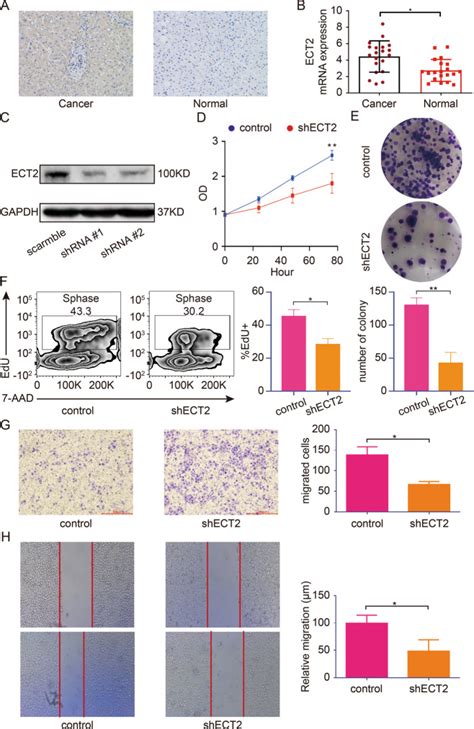 Ect2 Overexpression Promotes The Polarization Of Tumor Associated