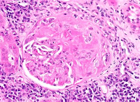 Nat Pernick On Linkedin This Essay Discusses The Movement To Abandon