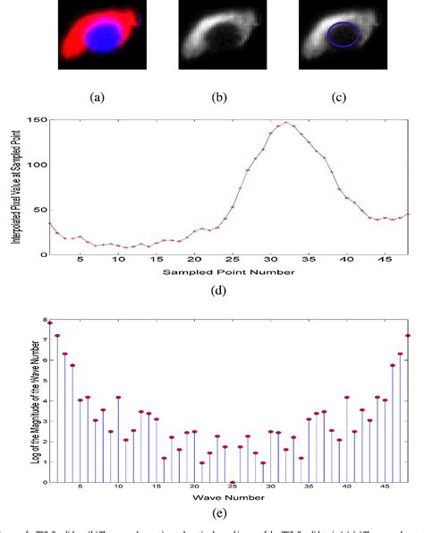 Figure From Computerized Medical Imaging And Graphics Semantic Scholar