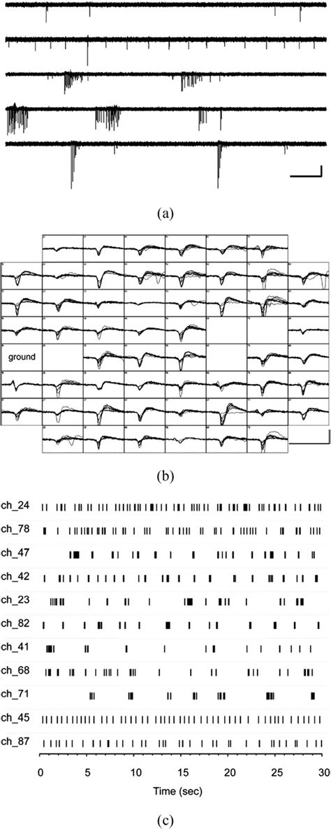 A Extracellular Neural Signal Traces Recorded Simultaneously From 5