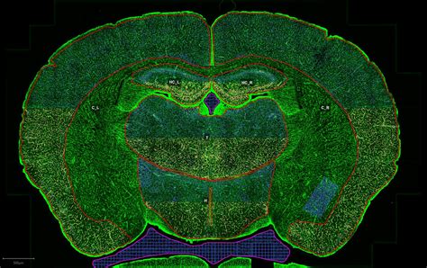 Qupath Annotation Outline In Two Colours Usage And Issues Image Sc Forum