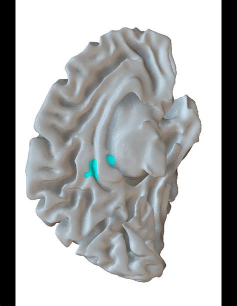 Using Freesurfer Version 6 0 0 Surfer Download Scientific