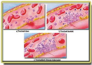Silviaquerida Tentang TROMBOSIT