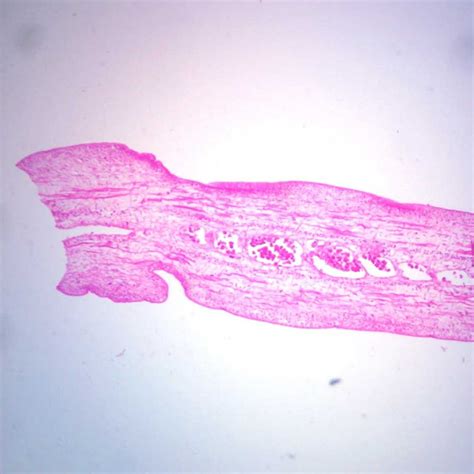 Taenia Tapeworm Segment