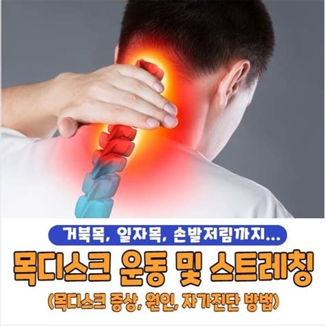 목디스크 운동 및 스트레칭 증상 원인 자가진단 치료방법 총정리