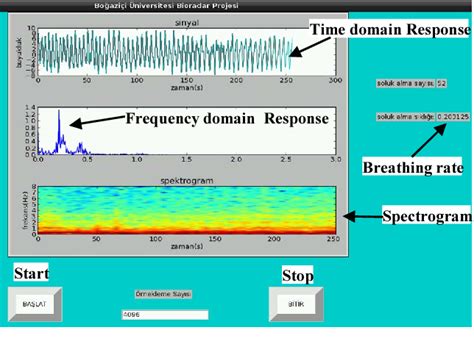 A K Band Radar System For Remote Cardiorespiratory Monitoring Semantic Scholar