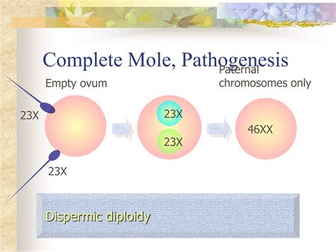 Molar Pregnancy Pptx