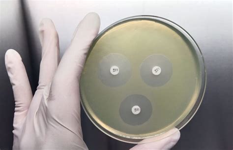 How Is The Zone Of Inhibition Measured