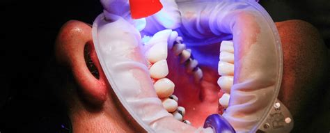 Tooth Hardness Nanovea