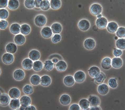 Polymorphonuclear Leukocytes With The Typical Granular Cytoplasm And Lobated Nucleus Phase