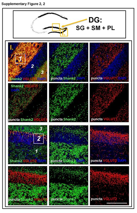 Selective Localization Of Shanks To Vglut1 Positive Excitatory Synapses In The Mouse Hippocampus