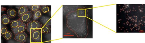 Result Of Segmentation And Spot Detection Segmentation Is Performed