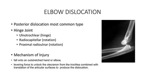 Elbow Dislocations Radial Head Fractures Olecranon Fractures Ppt