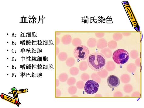 人血涂片 Word文档在线阅读与下载 无忧文档