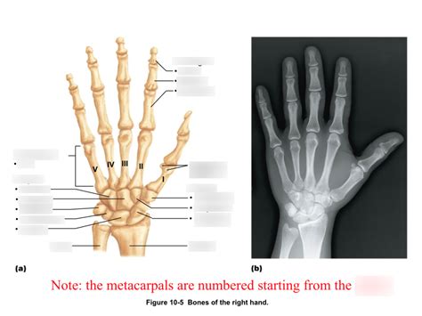 Hand Manus Diagram Quizlet