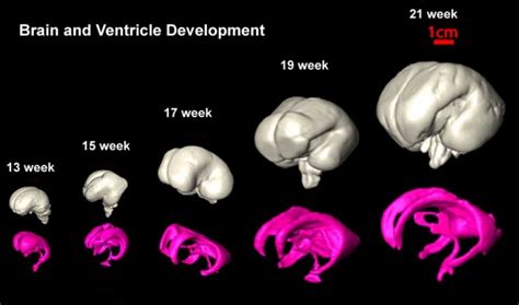 Neural Ventricular System Development Embryology