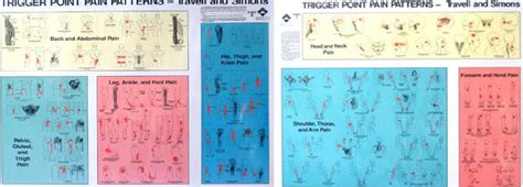 Healing Your Body Trigger Point Map