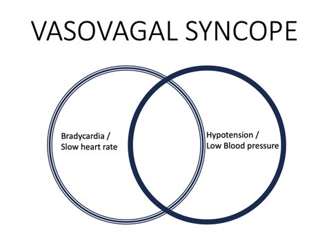 Vasovagal Syncope Dr Hari Sugumar Electrophysiologist And Cardiologist