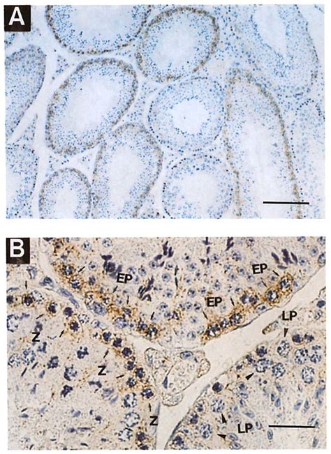 Immunohistochemical Staining With Mab Bc7 In Testicular Cross Sections Download Scientific