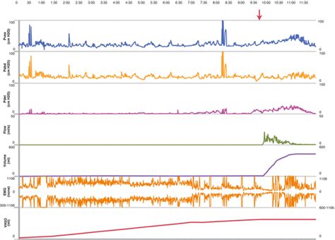 Bladder Emptying Contractility Abdominal Key