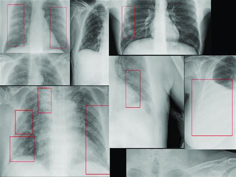 Region Of Interests For Opacity Localisation Download Scientific Diagram