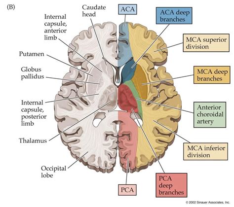 Flashcards Lect 23 Aphasias And Cortical Syndromes Brocas