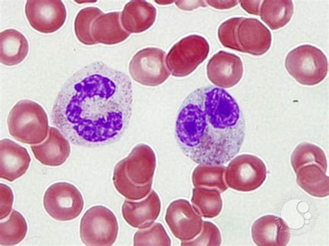 Pseudo Pelger Huët Anomaly