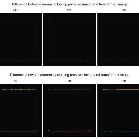 Difference Between Pulsating Pressure Images And Transformed Images If