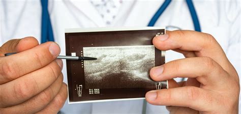 Advantages Of 3d 4d Ultrasound