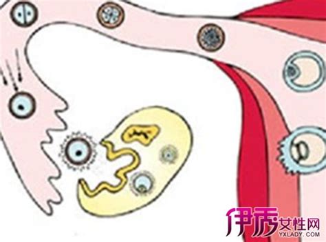 输卵管炎症吃什么药图输卵管炎症吃什么药调理好 得了输卵管炎症怎么办 伊秀健康 yxlady