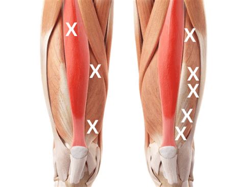 Pectoralis Trigger Points How To Find And Release