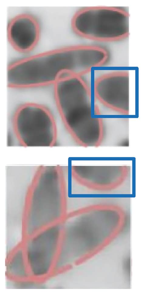 Results For Chromosome Overlapping Segmentation Individual Chromosome