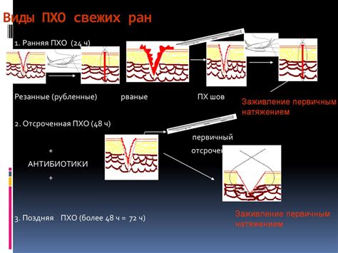 Раны и раневой процесс - презентация онлайн