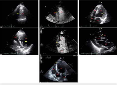 Image Illustrates Multiple Long Axis And Short Axis Views Of Download Scientific Diagram