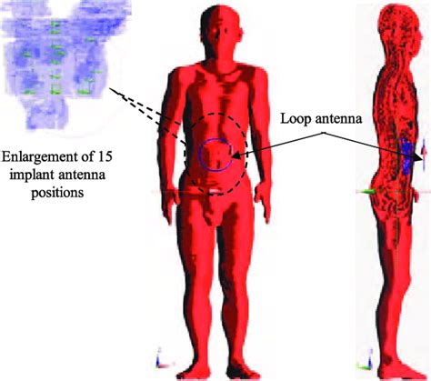 Fdtd Simulation Model Of An Anatomical Human Body With Implant And Download Scientific Diagram