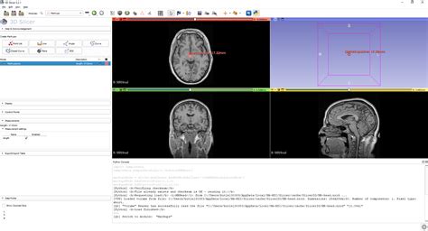 Markupsline Not Showing Length Measurement Support 3d Slicer Community