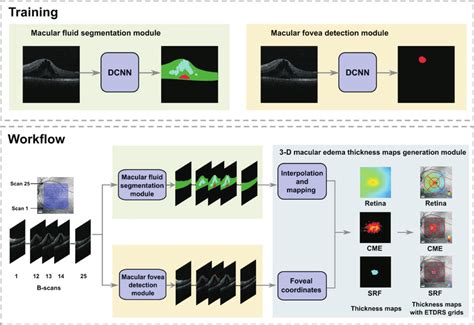 Training Of Macular Fluid Segmentation Module And Macular Fovea