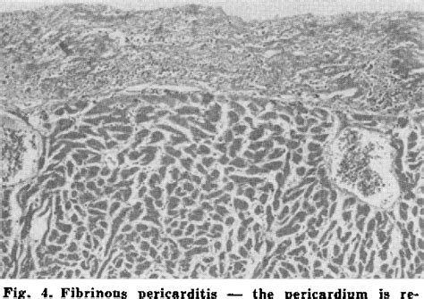 Figure 1 From Diplococcus Pneumoniae Type 16 In Laboratory Rats Semantic Scholar