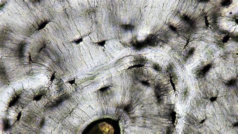 Bone Cross Section Histology What Is The Structure And Function Of