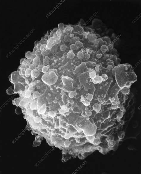 Sem Of T Cell Infected With Hiv Stock Image M050 0141 Science Photo Library