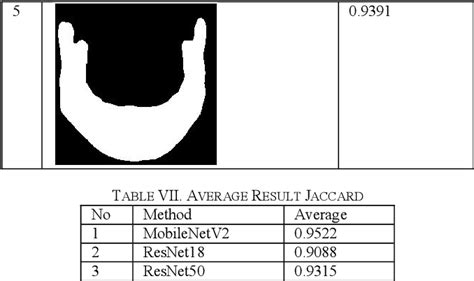 Table Vii From Mandibular Segmentation On Panoramic Radiographs With