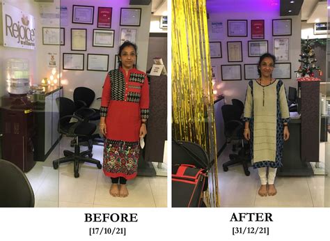 Transformation Mrs Vidhya Ganesh Rejoice Wellness