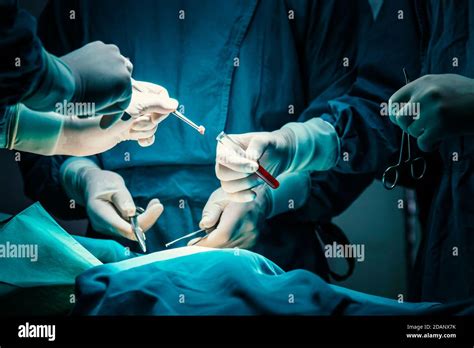 Concentrated Professional Surgical Doctor Team Operating Surgery A Patient In The Operating Room