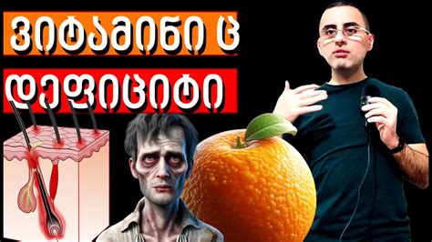 ც ვიტამინის დეფიციტის ნიშენები და მკურნალობა Youtube