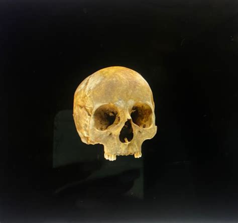 Solved Specimen 4 Sex Estimation Conclusion Based On The