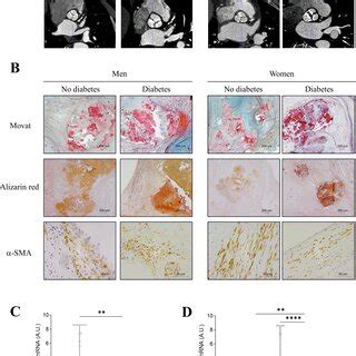 Sex Differences In Oxidative Stress Markers In Non Diabetic And Download Scientific Diagram