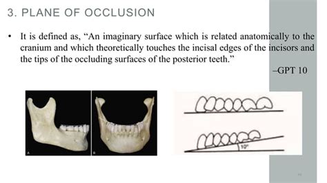 Occlusal Schemes In Cddr Shuchi Jainpptx Dental Health Diseases