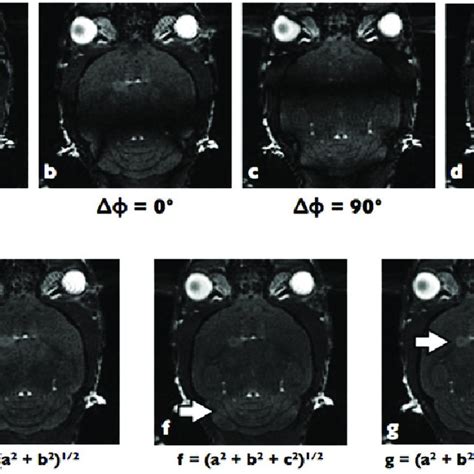 Brain Images From A Mouse With An Implanted Tumor On Day 4 After Download Scientific Diagram