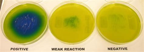 Reactions Of Various Cryptococci On Cgb Agar The Left Plate Depicts A Download Scientific
