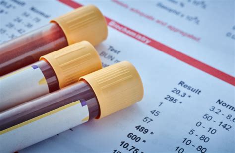 The Complete Guide To Mcas Causes Symptoms And Solutions